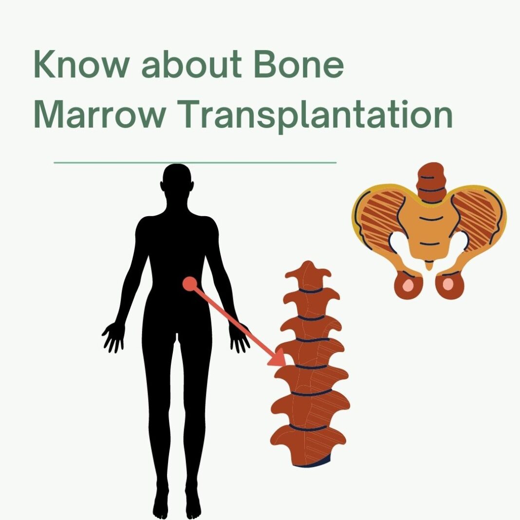 What Do You Mean by a BMT Procedure? | 'Monomousumi'